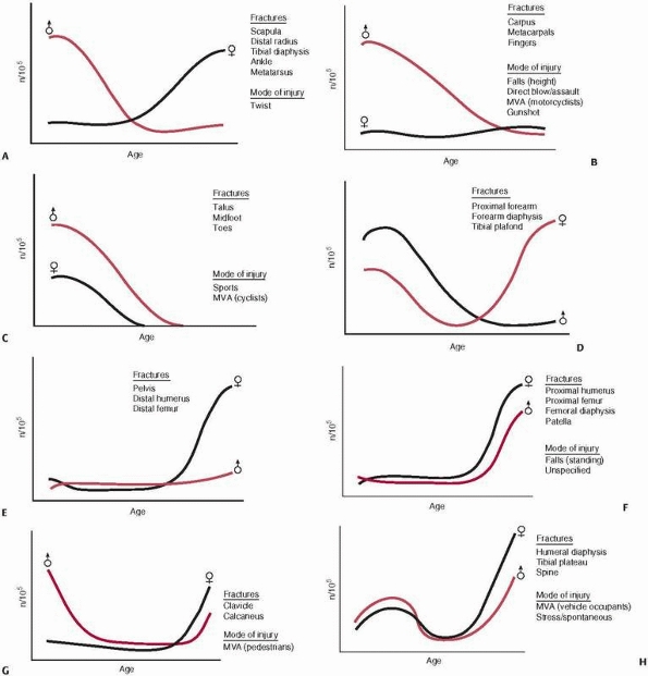 The Epidemiology Of Fractures Teachme Orthopedics